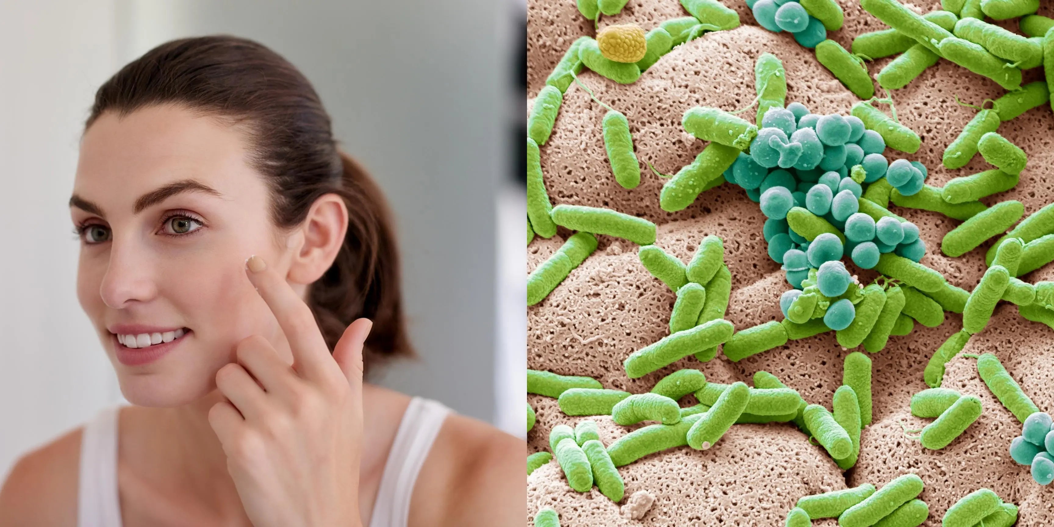 belang prebiotica huid microbioom balans | acne genezen, acneoplossing ...